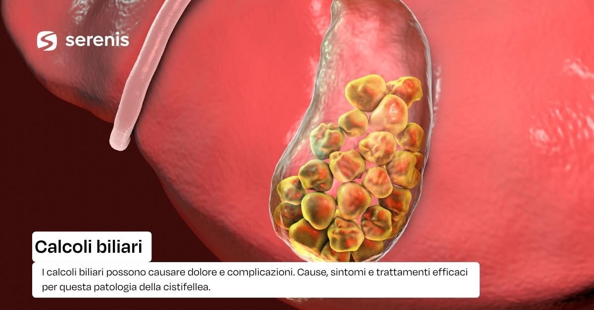 Calcoli biliari: cosa sono, cause e sintomi