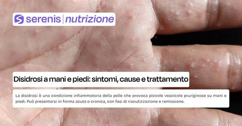 Disidrosi a mani e piedi: sintomi, cause e trattamento