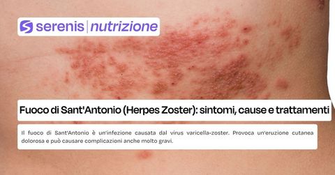 Fuoco di Sant'Antonio (Herpes Zoster): sintomi, cause e trattamenti