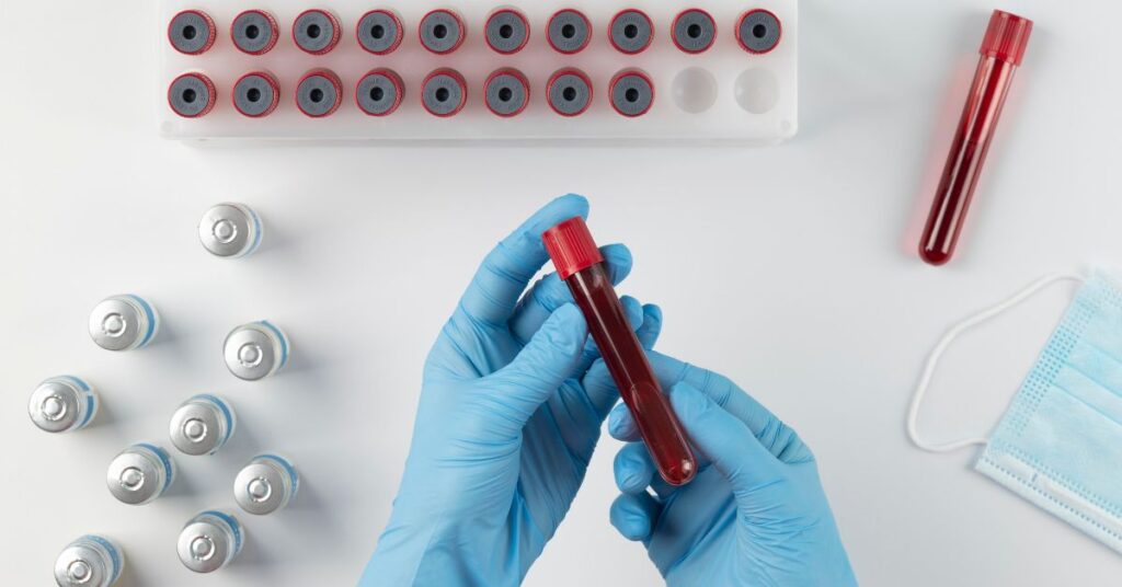 Volume corpuscolare medio o MCV: di cosa si tratta | Serenis